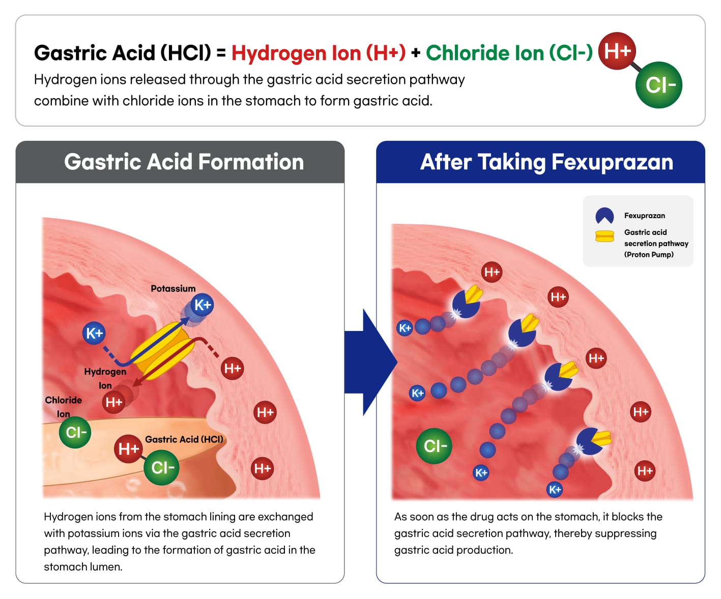 Pedoman pengobatan GERD terbaru di Indonesia soroti P-CAB sebagai opsi terapi baru
